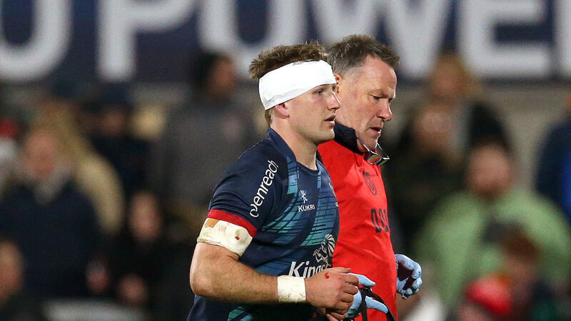 Concussion is the biggest issue facing rugby across all levels